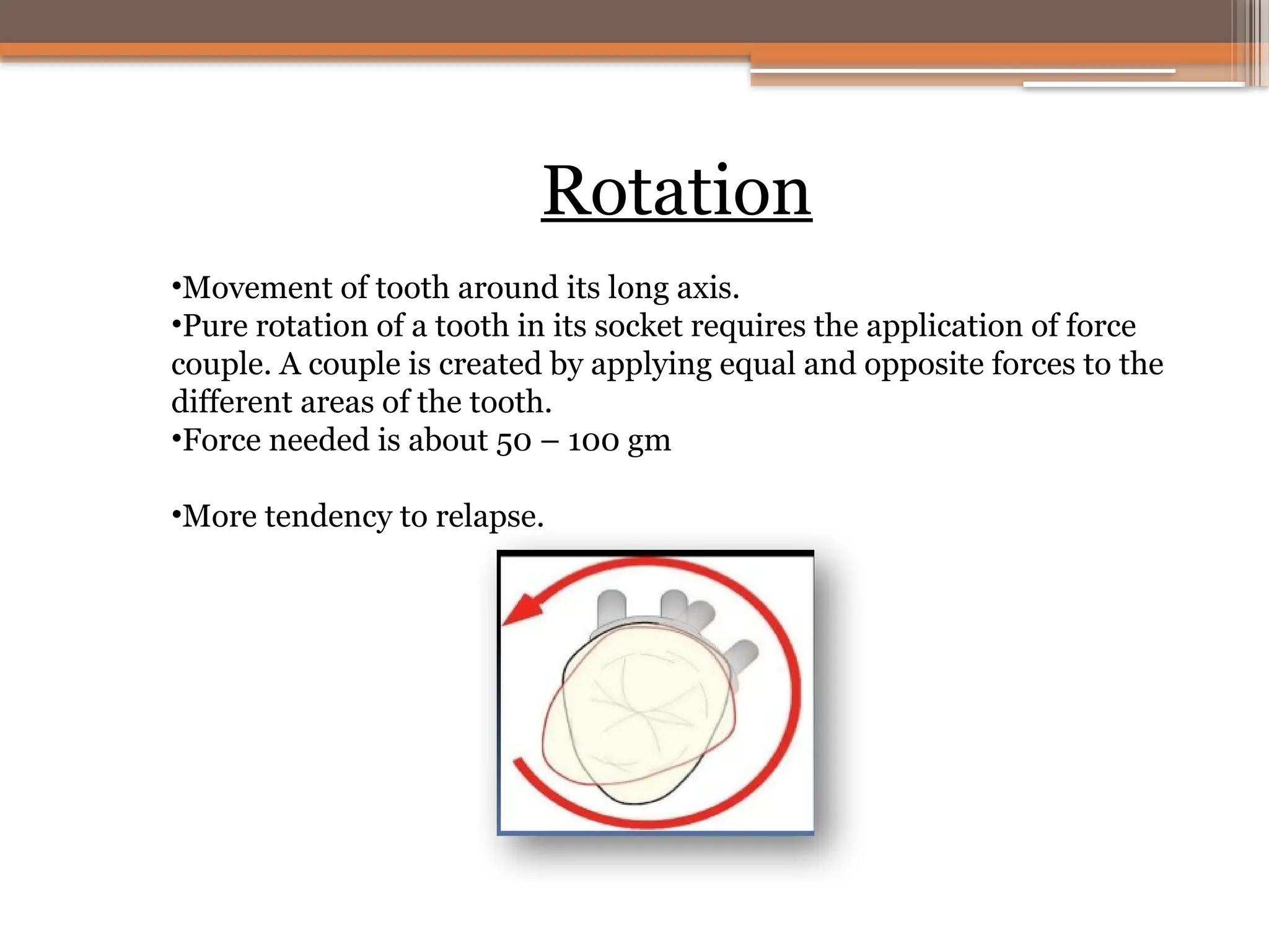 Mechanics of tooth movement, tooth movement in oral cavity | PPTX