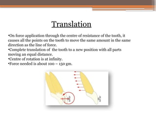 Mechanics of tooth movement, tooth movement in oral cavity | PPTX