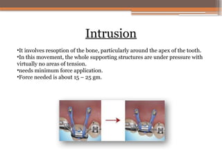 Mechanics of tooth movement, tooth movement in oral cavity | PPT