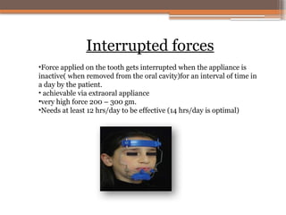 Mechanics of tooth movement, tooth movement in oral cavity | PPT