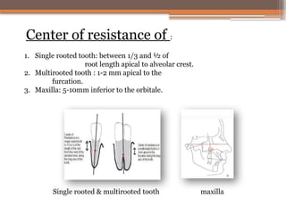 Mechanics of tooth movement, tooth movement in oral cavity | PPTX