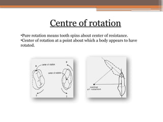 Mechanics of tooth movement, tooth movement in oral cavity | PPTX