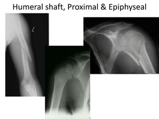 applied anatomy of shoulder joint | PPTX