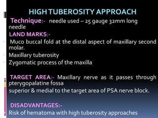 Maxillary Nerve Block High Tuberosity Approach
