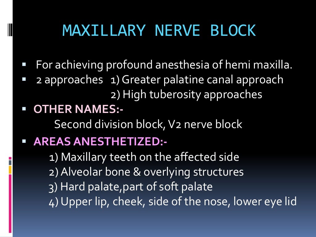 maxillary nerve block