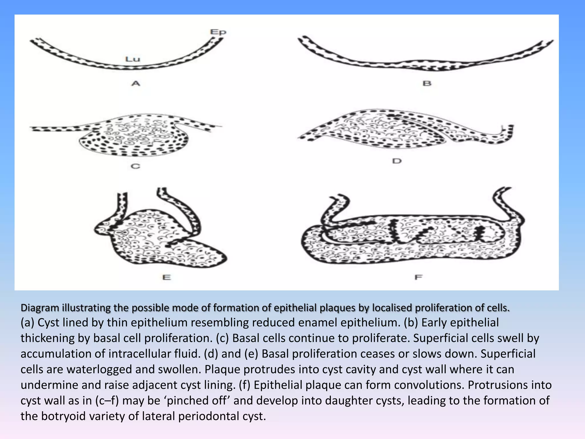odontogenic cysts | PPTX