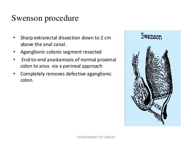 HIRSCHSPRUNG DISEASE...