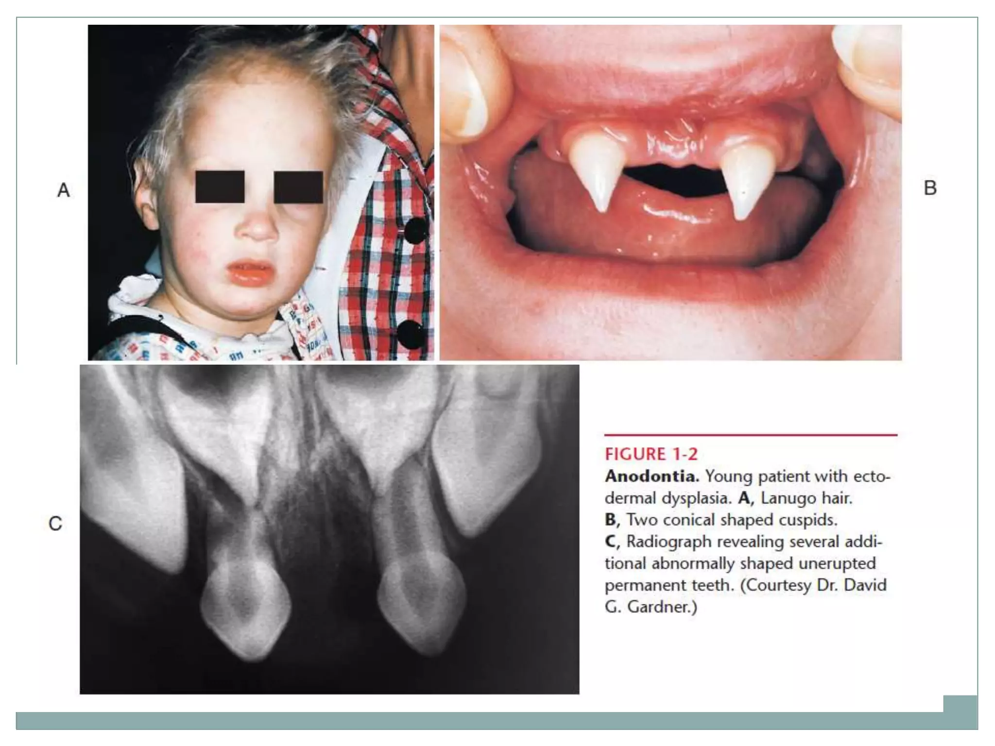 Dental anomalies | PPTX