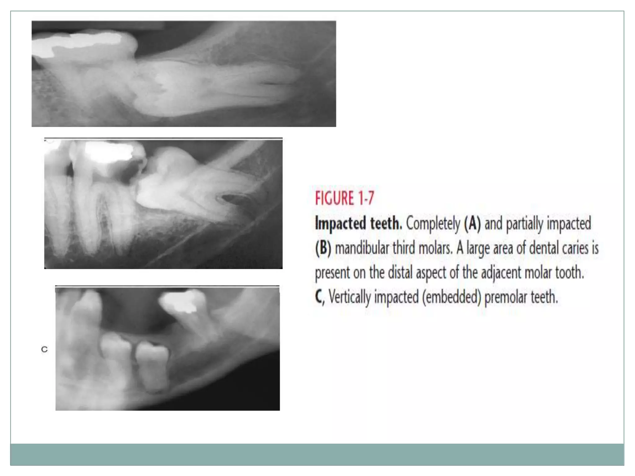 Dental anomalies | PPTX