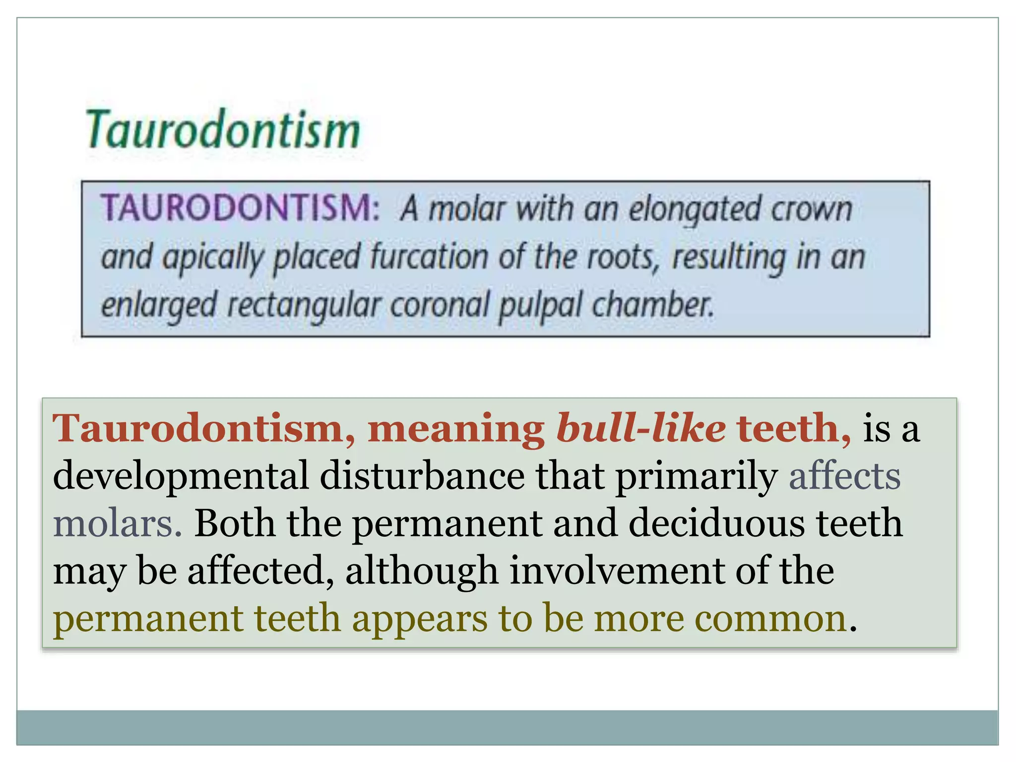 Dental anomalies | PPTX