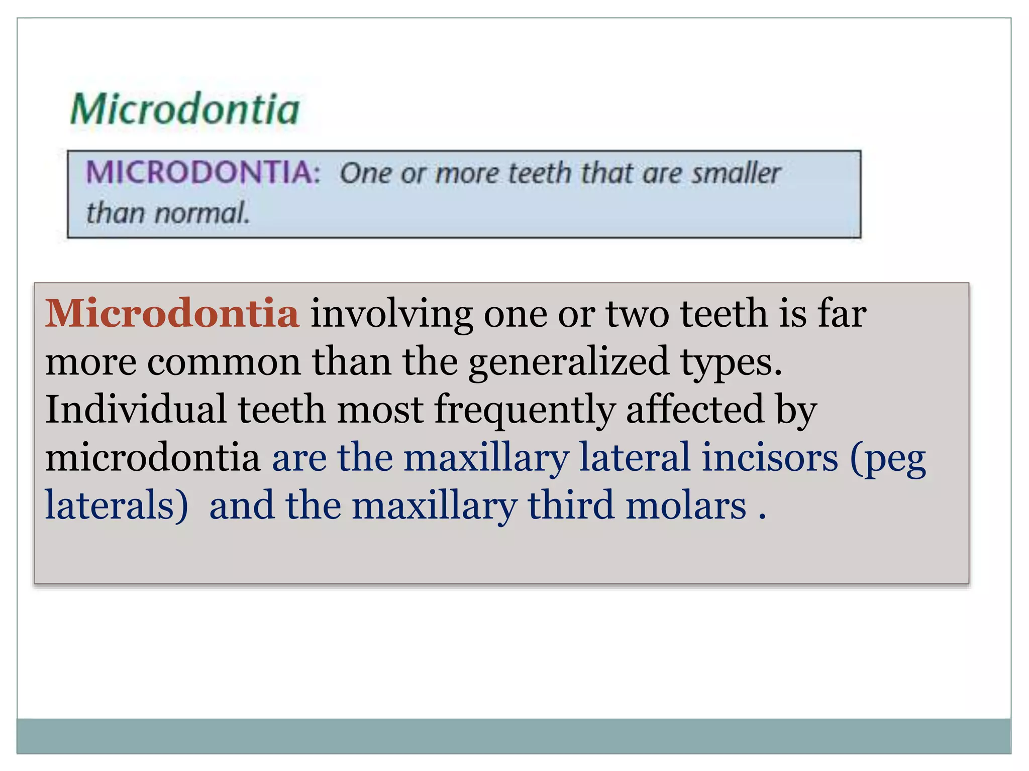 Dental anomalies | PPTX