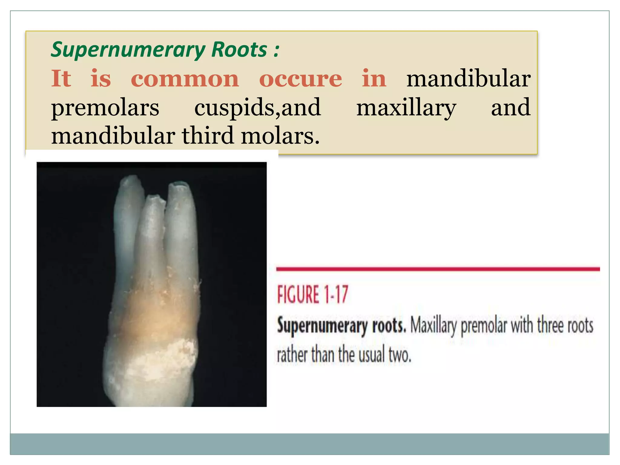 Dental anomalies | PPTX