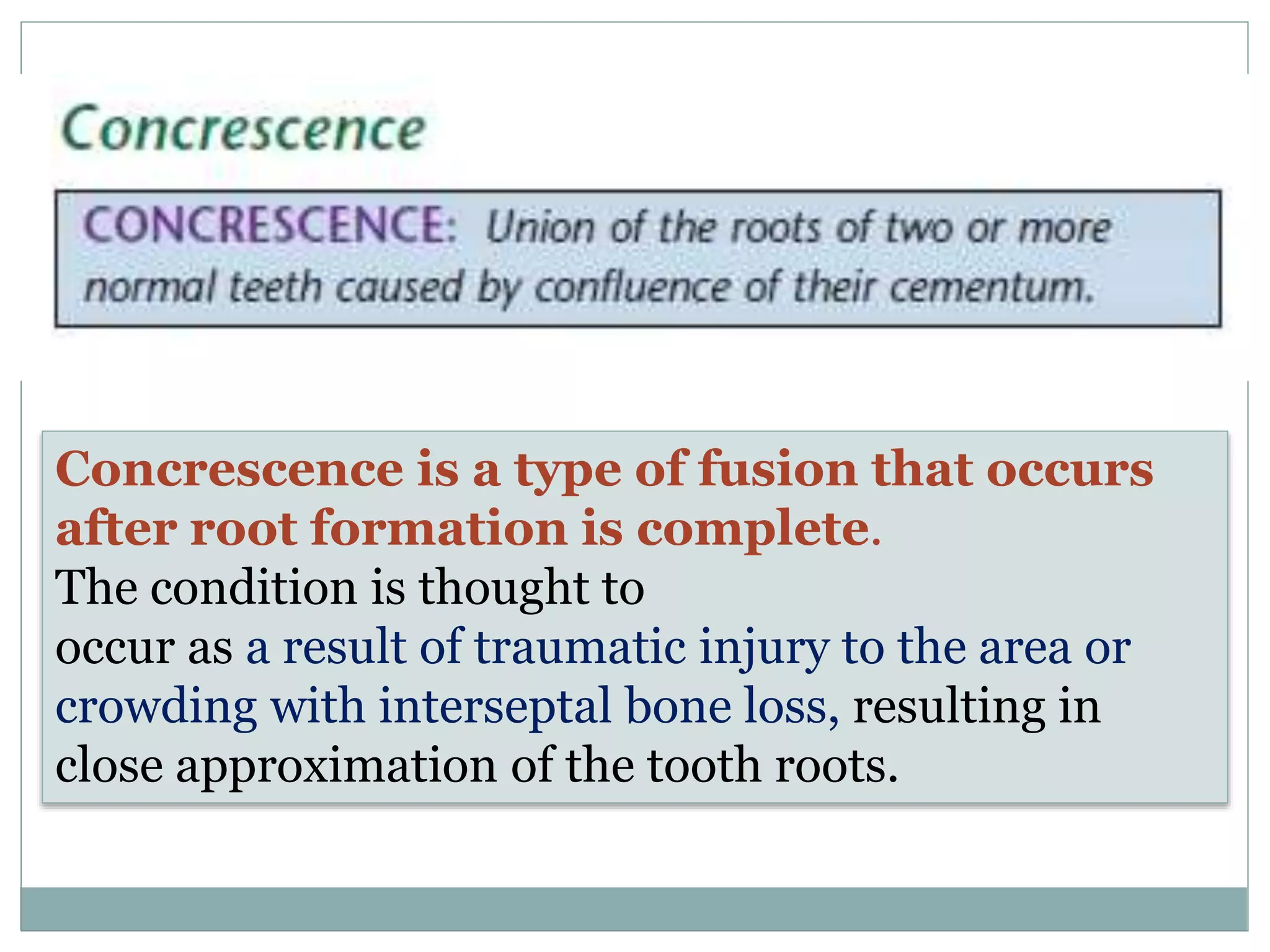 Dental anomalies | PPTX