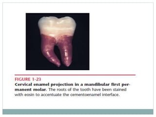 Cervical Enamel Projection