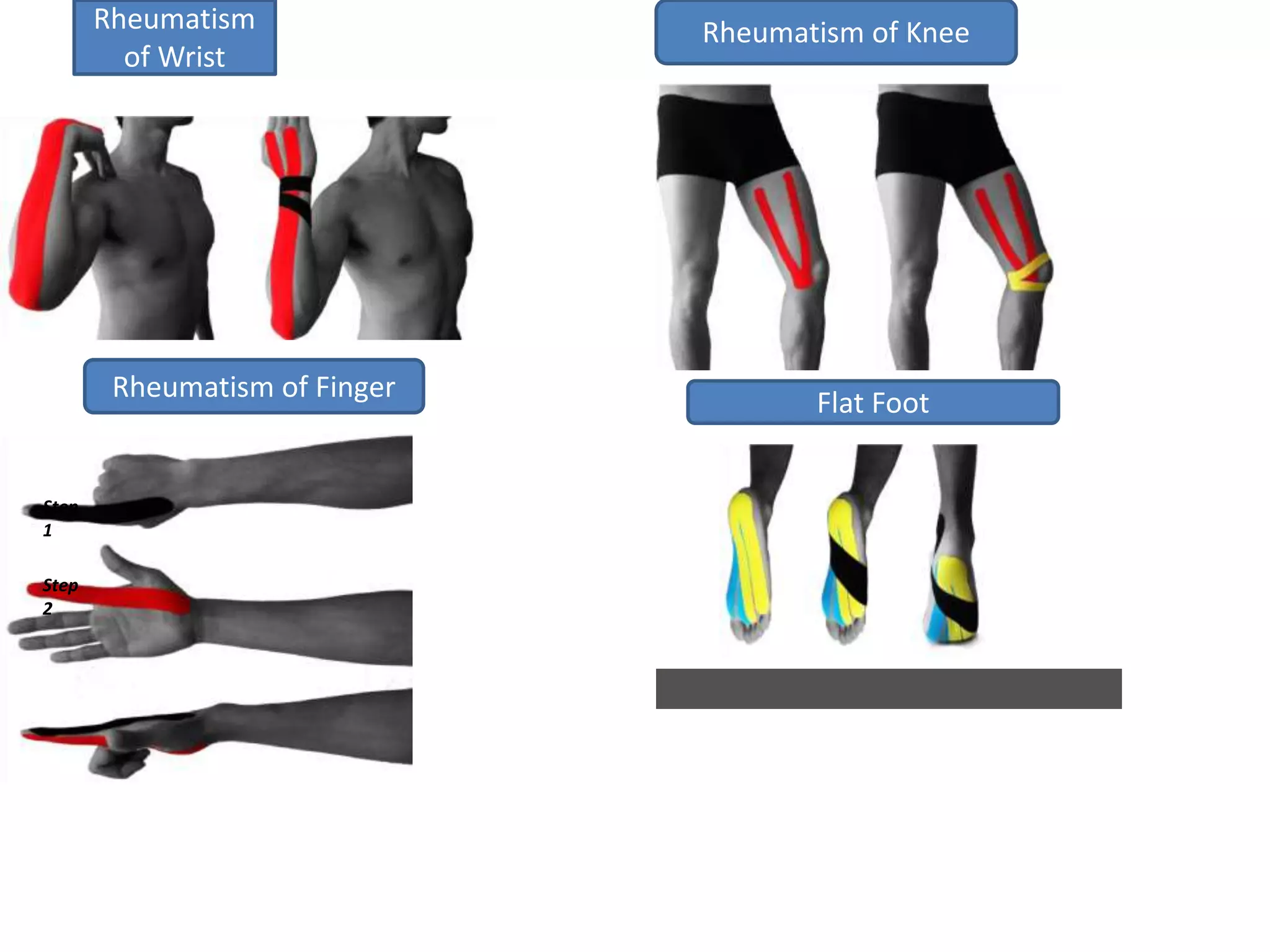 taping | PPTX | First Aid | Injuries