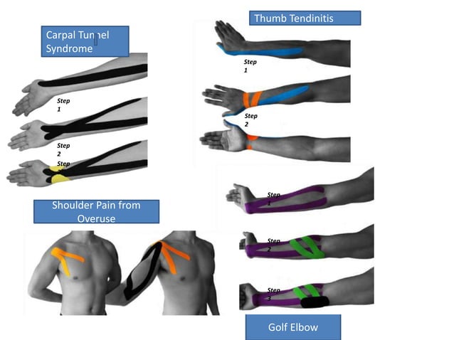 taping | PPTX | First Aid | Injuries