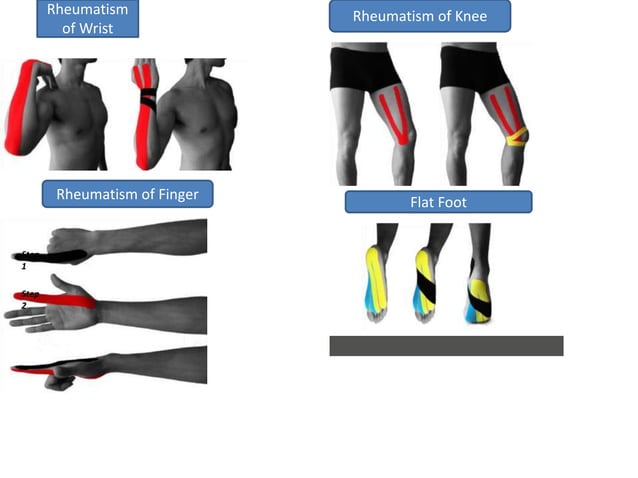 taping | PPTX | First Aid | Injuries