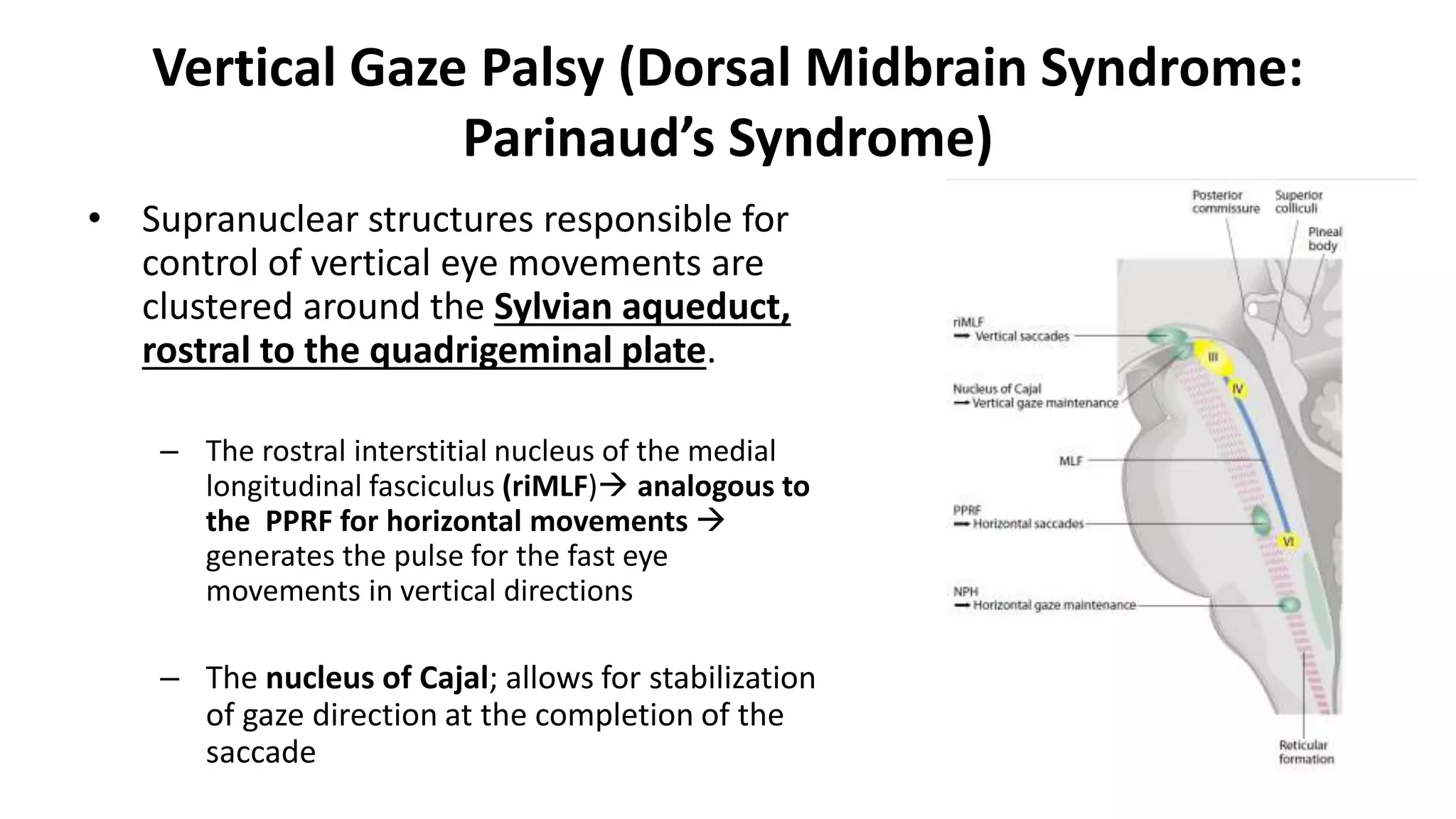 Supranuclear disorders of ocular motility | PPTX
