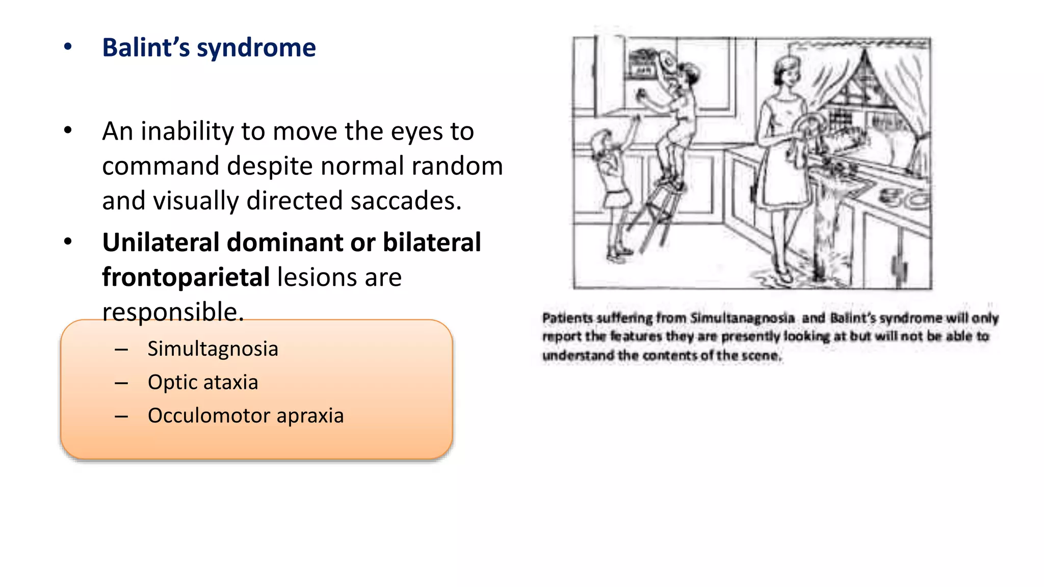 Supranuclear disorders of ocular motility | PPTX