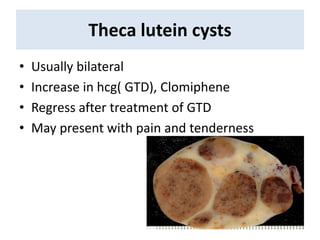 Aproach to ovarian masses and managemnt of benign ovarian masses | PPT