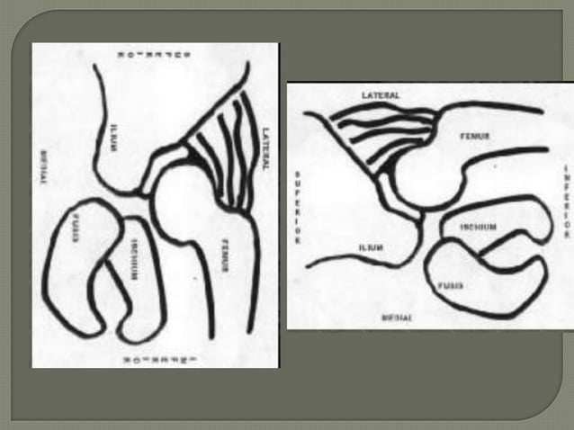 Pediatric hip radiology | PPTX