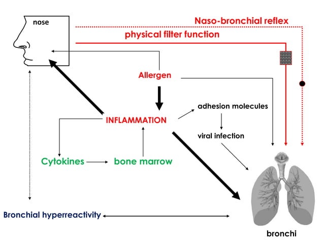 Asthma Rhinitis | PPTX
