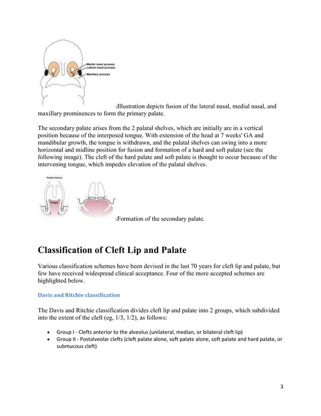 cleft lip & palate/orthodontics courses by indian dental academy | PDF