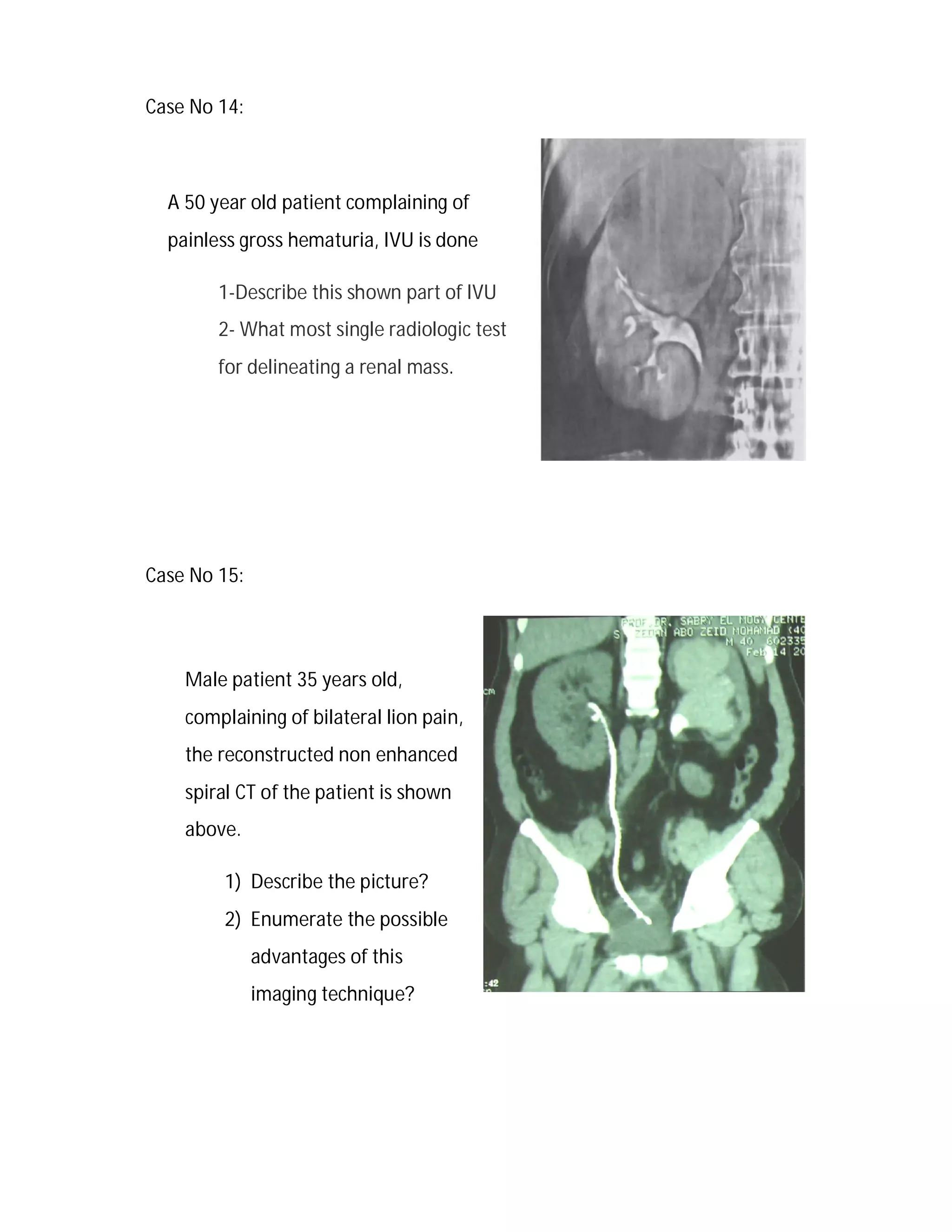 Common Cases of Urology | PDF
