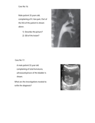Common Cases of Urology | PDF