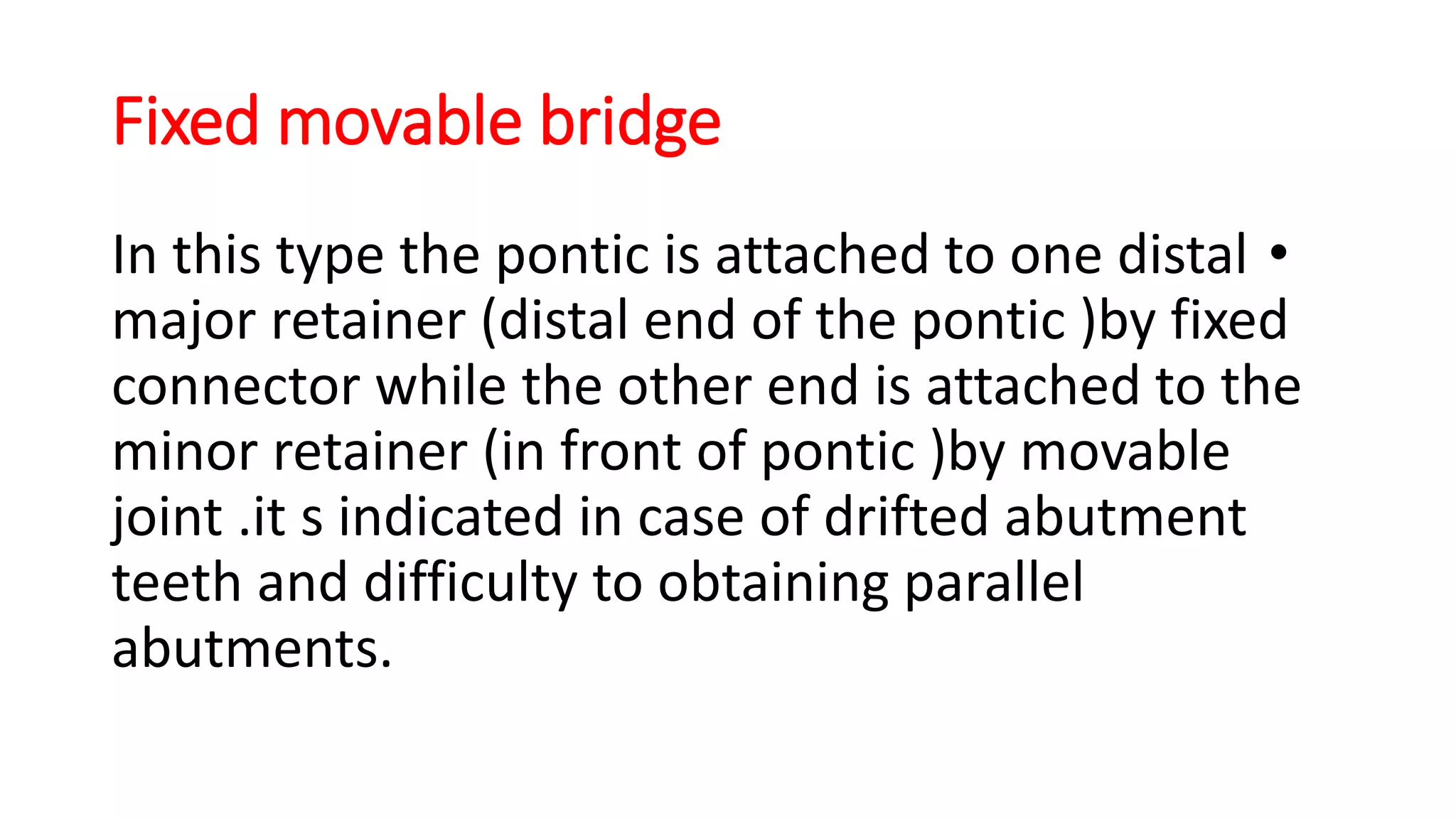 different designs of dental bridges | PPTX