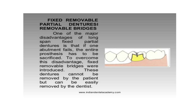 different designs of dental bridges | PPTX | Dental Health | Diseases ...