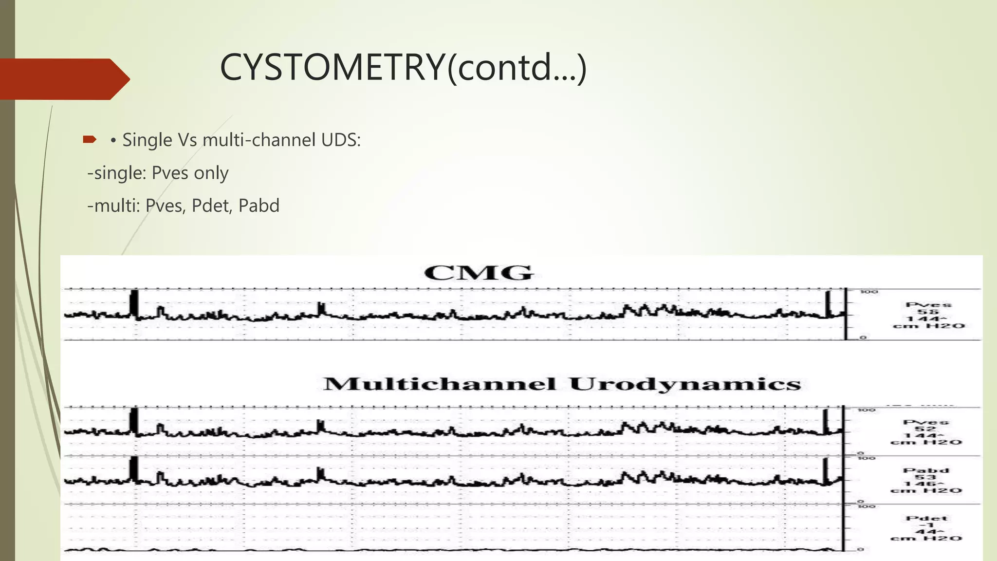 Urodynamics | PPTX