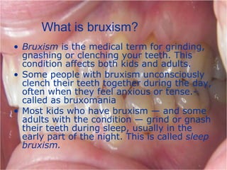 bruxism | PPT