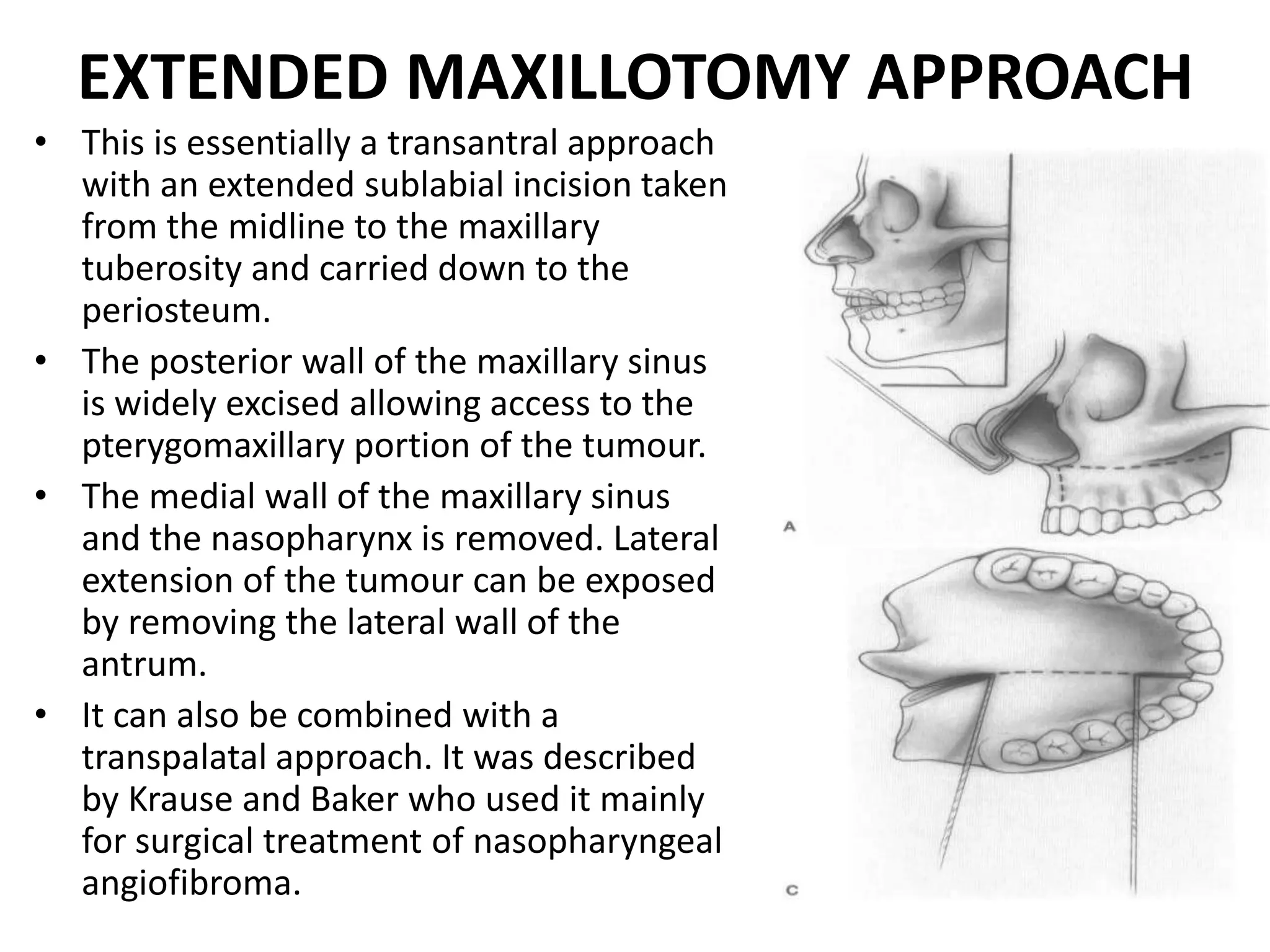 surgical & applied anatomy of temporal and infratemporal fossa | PPTX