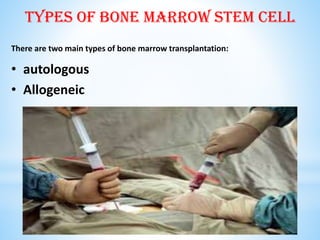 bone marrow transplantation by Ahmed Hamza | PPTX