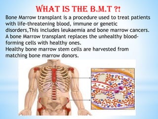 bone marrow transplantation by Ahmed Hamza | PPTX