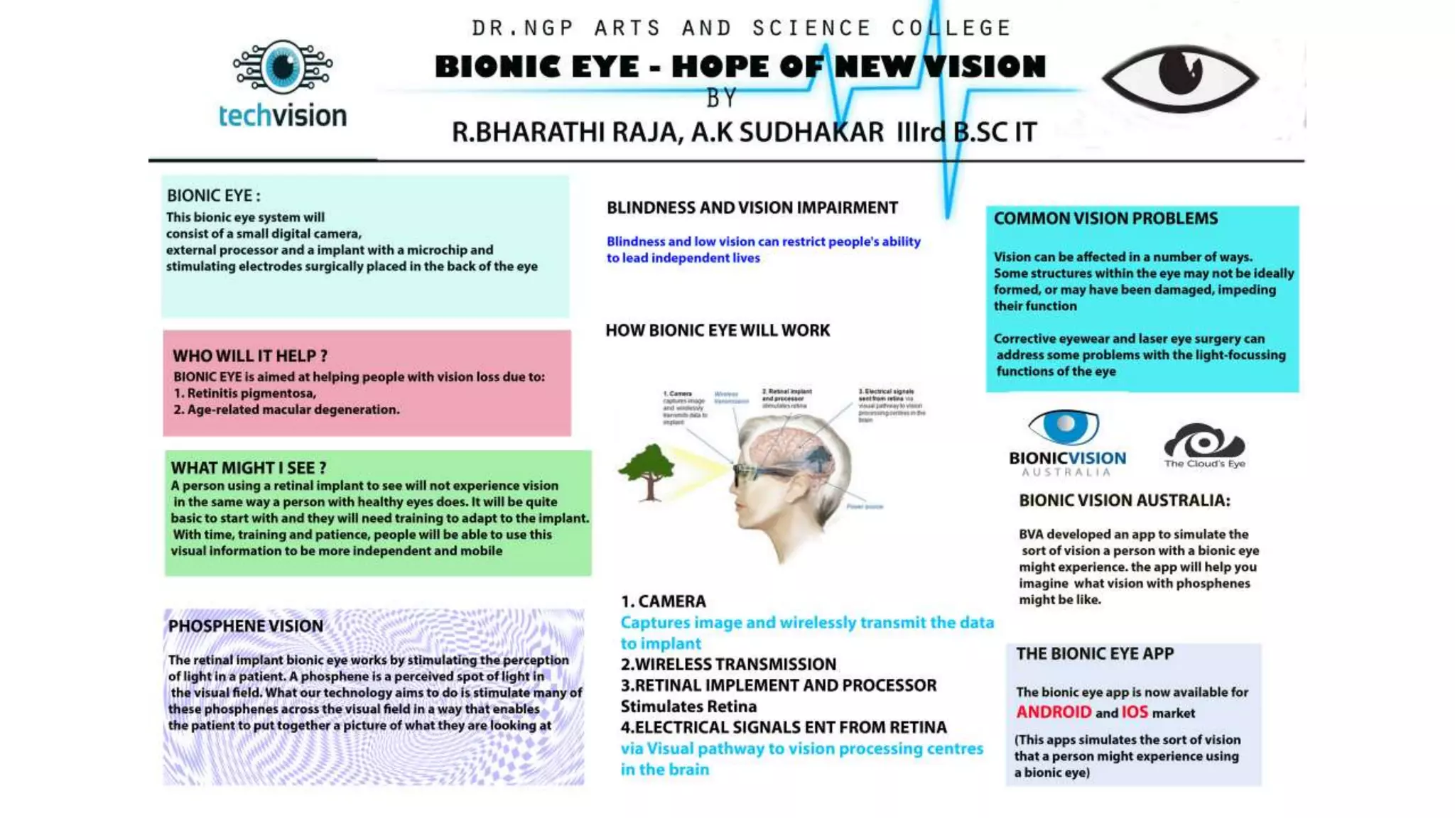 Bionic Eye Poster | PPT