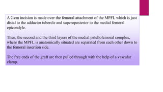 patellar dislocation | PPTX