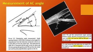 ultrasound biomicroscopy | PPTX