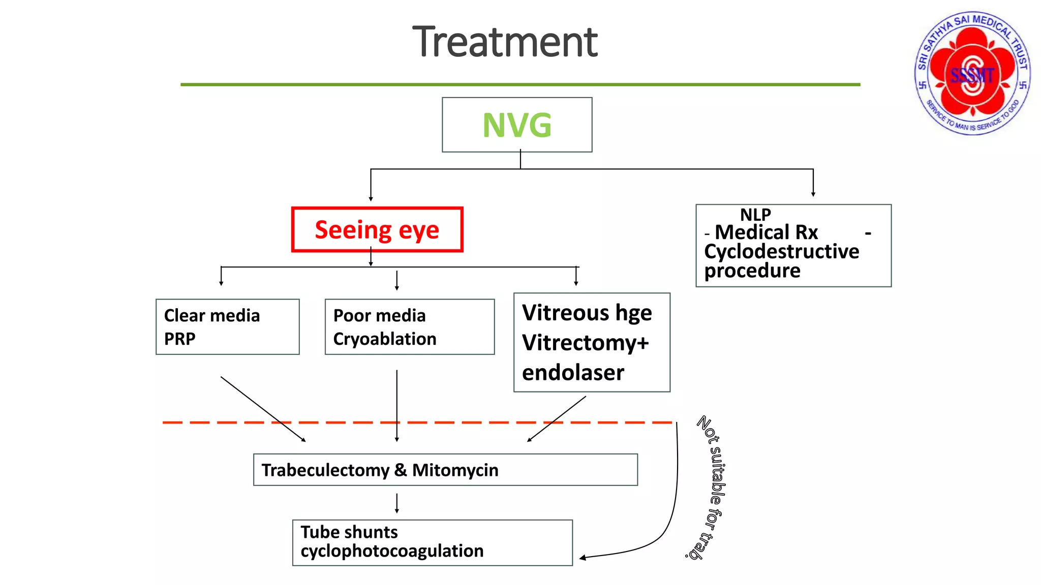 neovascular glaucoma | PPTX