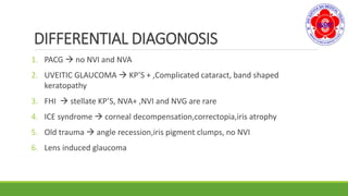 neovascular glaucoma | PPTX