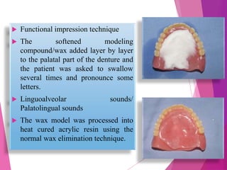Journal Club for prosthodontics | PPTX