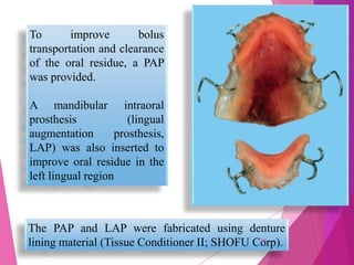 Journal Club for prosthodontics | PPTX