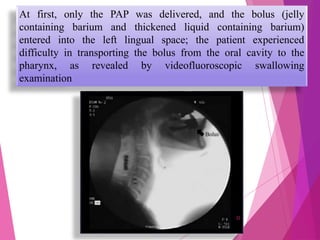 Journal Club for prosthodontics | PPTX