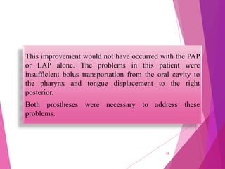 Journal Club for prosthodontics | PPTX