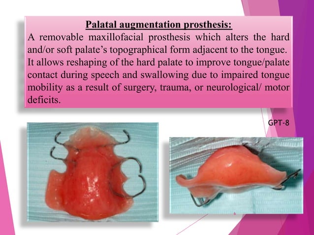 Journal Club for prosthodontics | PPTX | Dental Health | Diseases and ...