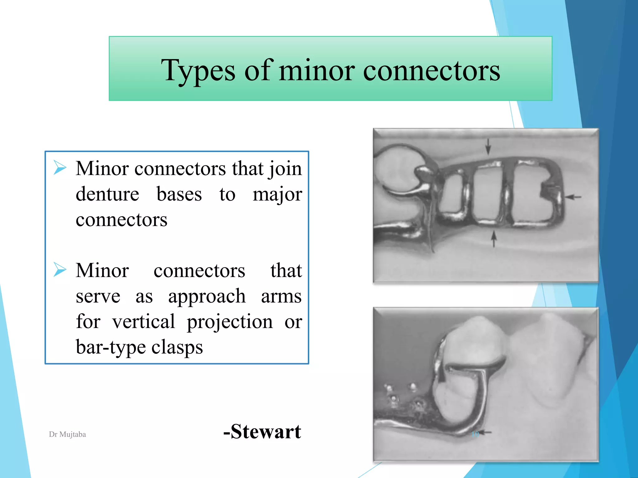 Minor connectors, rests & rests seats In prosthodontics | PPTX