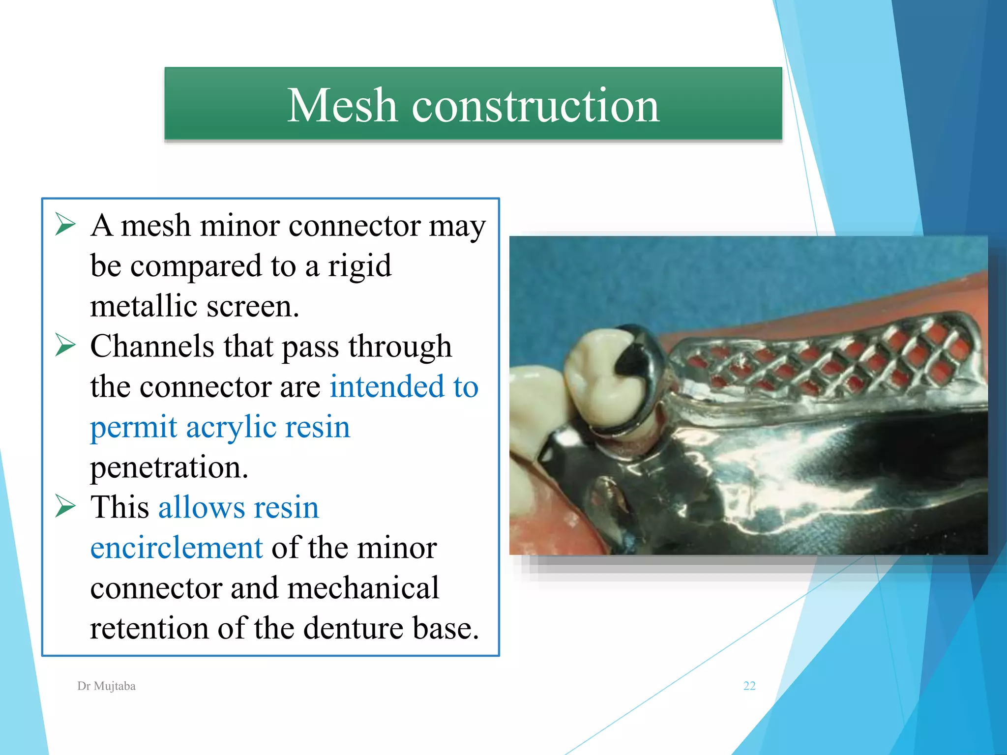 Minor connectors, rests & rests seats In prosthodontics | PPTX