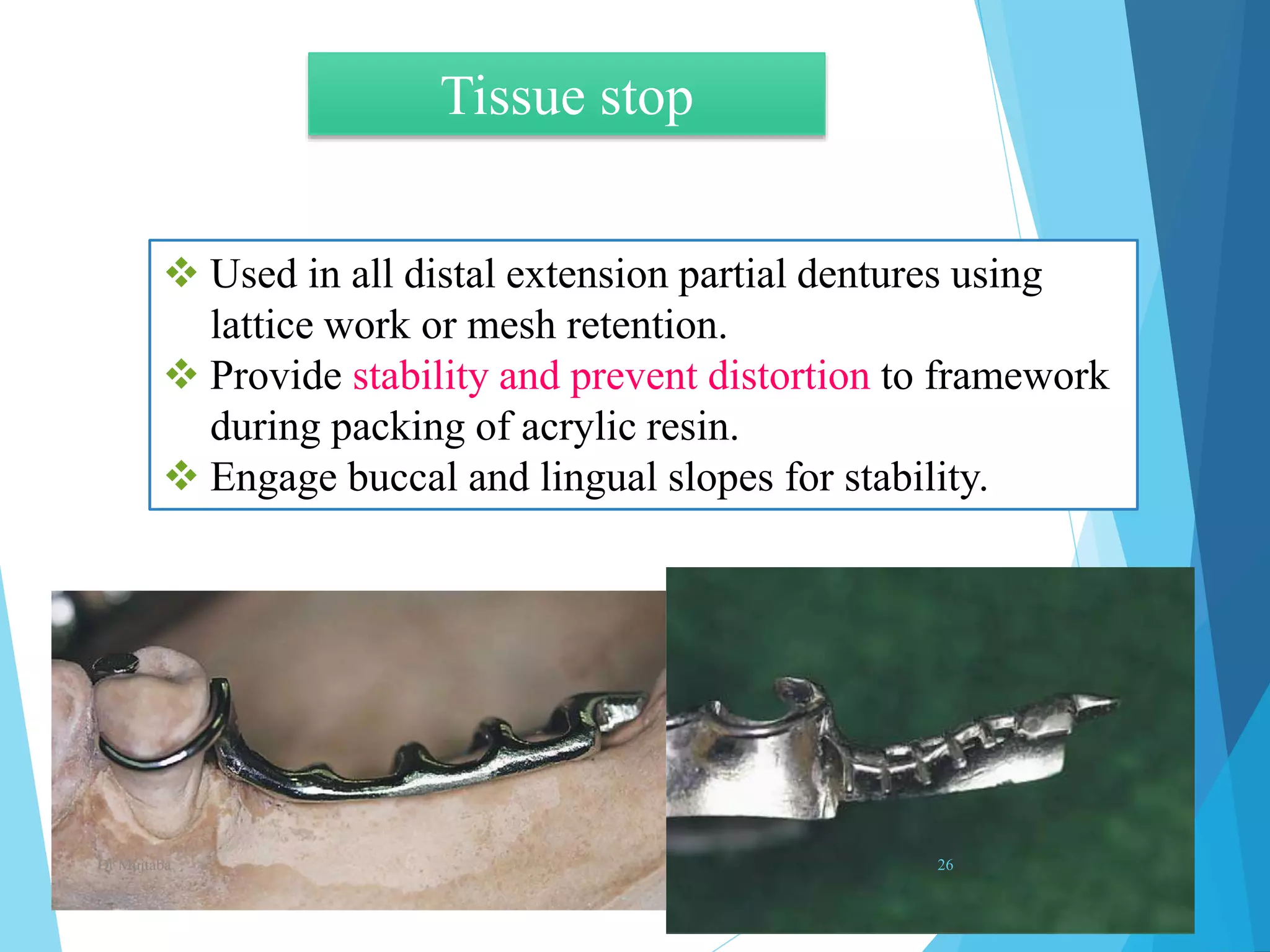 Minor connectors, rests & rests seats In prosthodontics | PPTX
