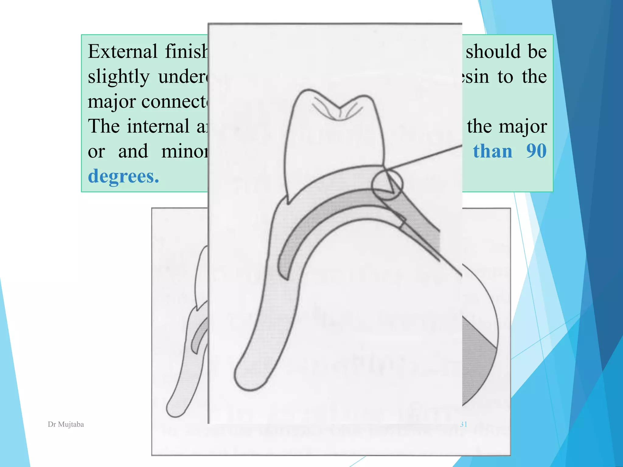 Minor connectors, rests & rests seats In prosthodontics | PPTX